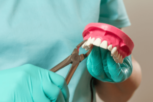 Tooth Removal (Extraction) – Dental Square